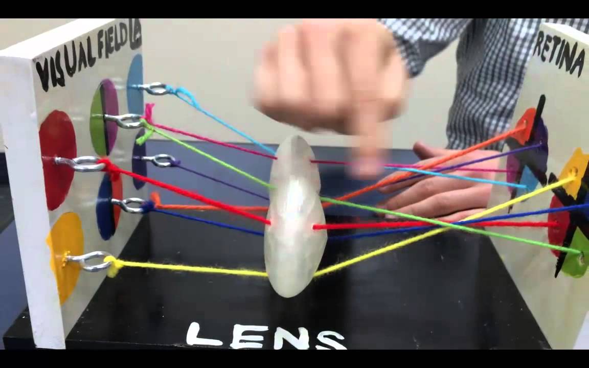 Visual Pathway Overview Youtube