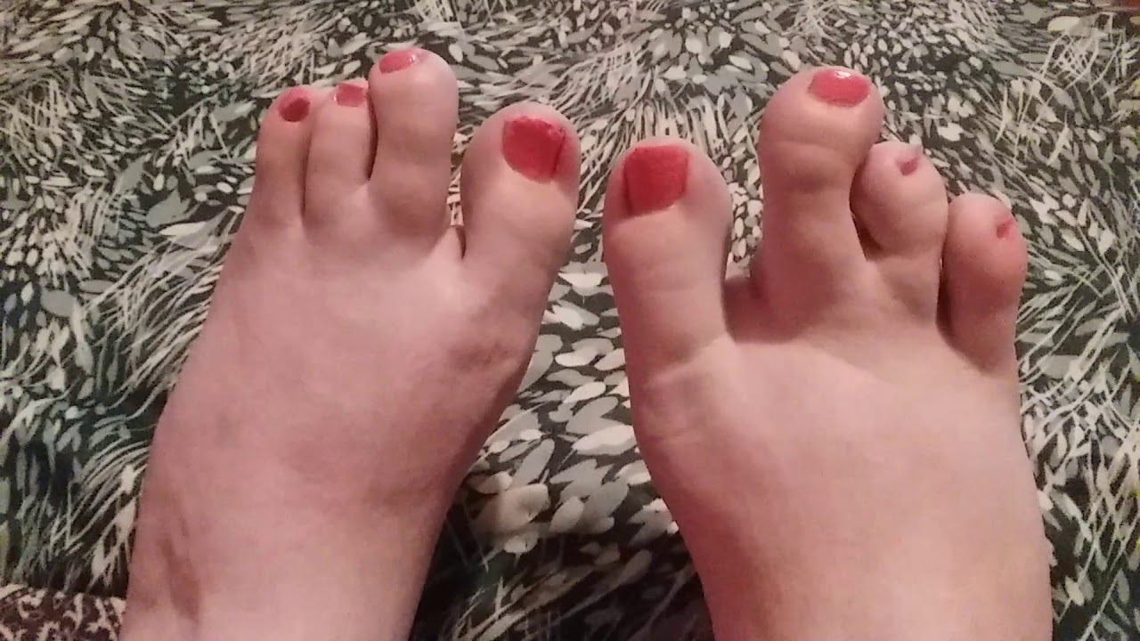 Foot And Ankle Disabilities Youtube