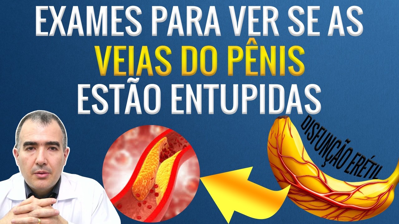 Falta De Ereção Exames Para Ver Se As Veias Do Pênis Estão Entupidas