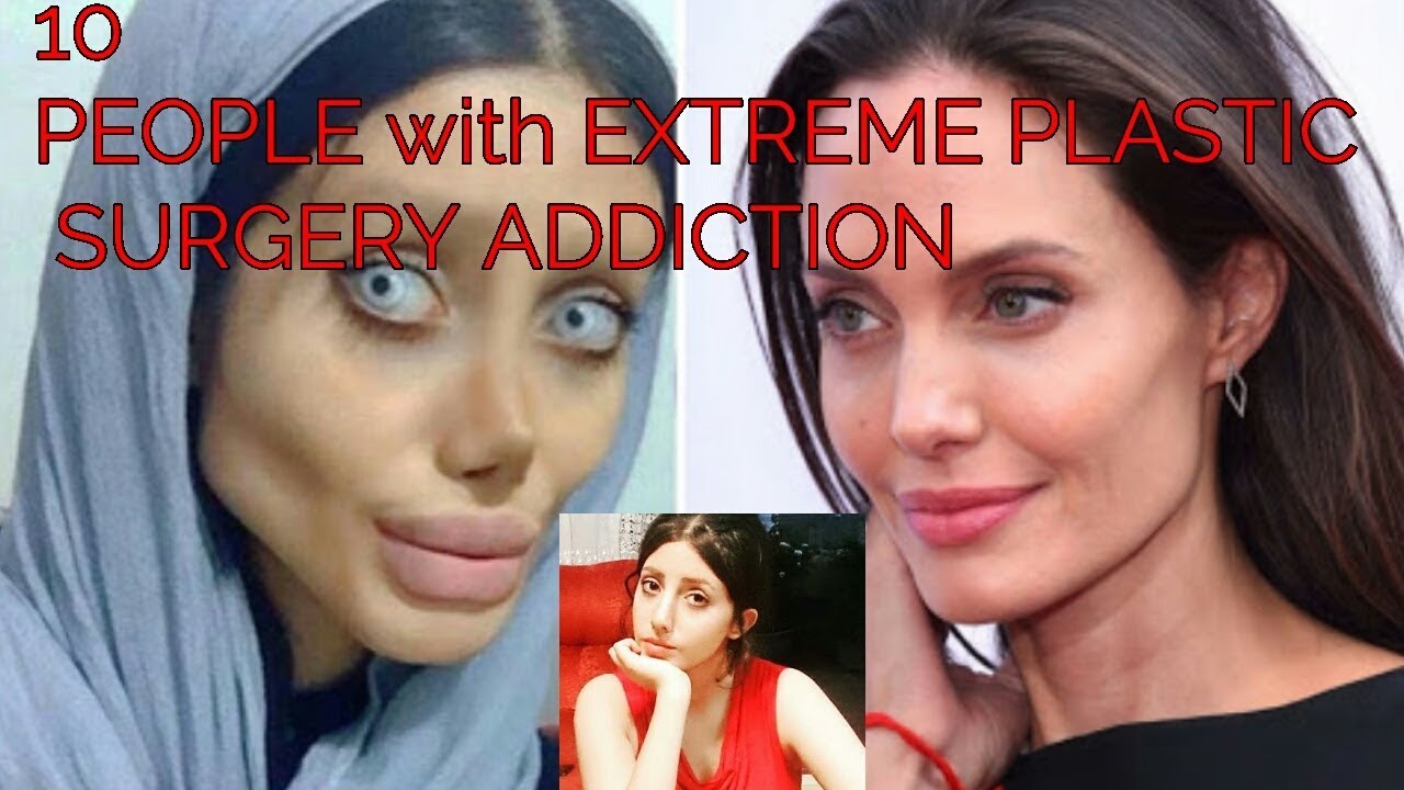 10 People Addiction With Extreme Plastic Surgery Youtube