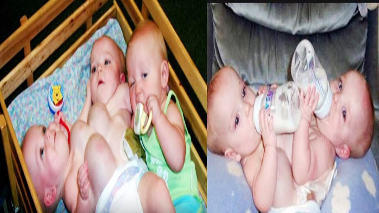 16 Years Ago The Most Unusual Triplets In The World Were Born And Are