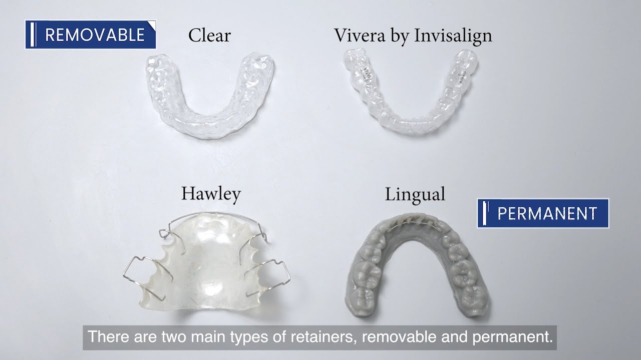 All You Need To Know About Orthodontic Retainers Braces Vs 45 Off