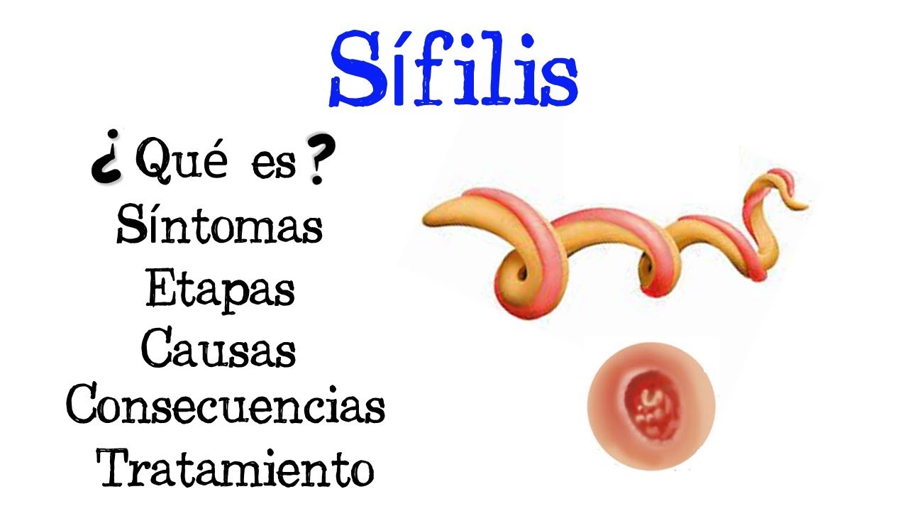 Qué Es La Sífilis Síntomas Etapas Causas Consecuencias Fácil