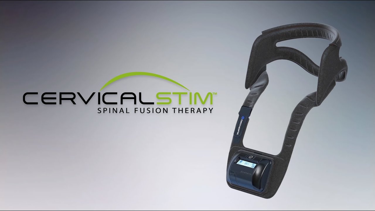 The Orthofix Cervicalstim邃 Device Youtube