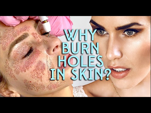 Sandra Green On Linkedin Google Image Result For Https I Ytimg