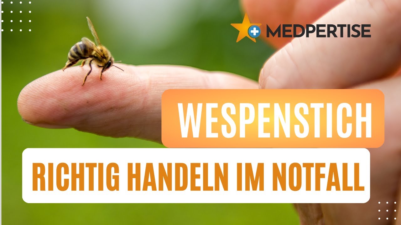 Allergie Bei Wespenstich Richtig Handeln Im Notfall So Musst Du