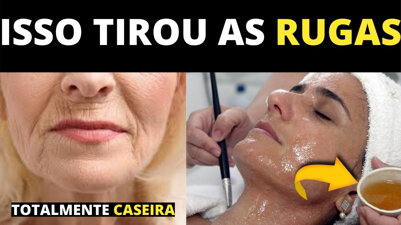 Mascara Tira Rugas Rápido Veja Como Acabar Com As Rugas E Linhas De