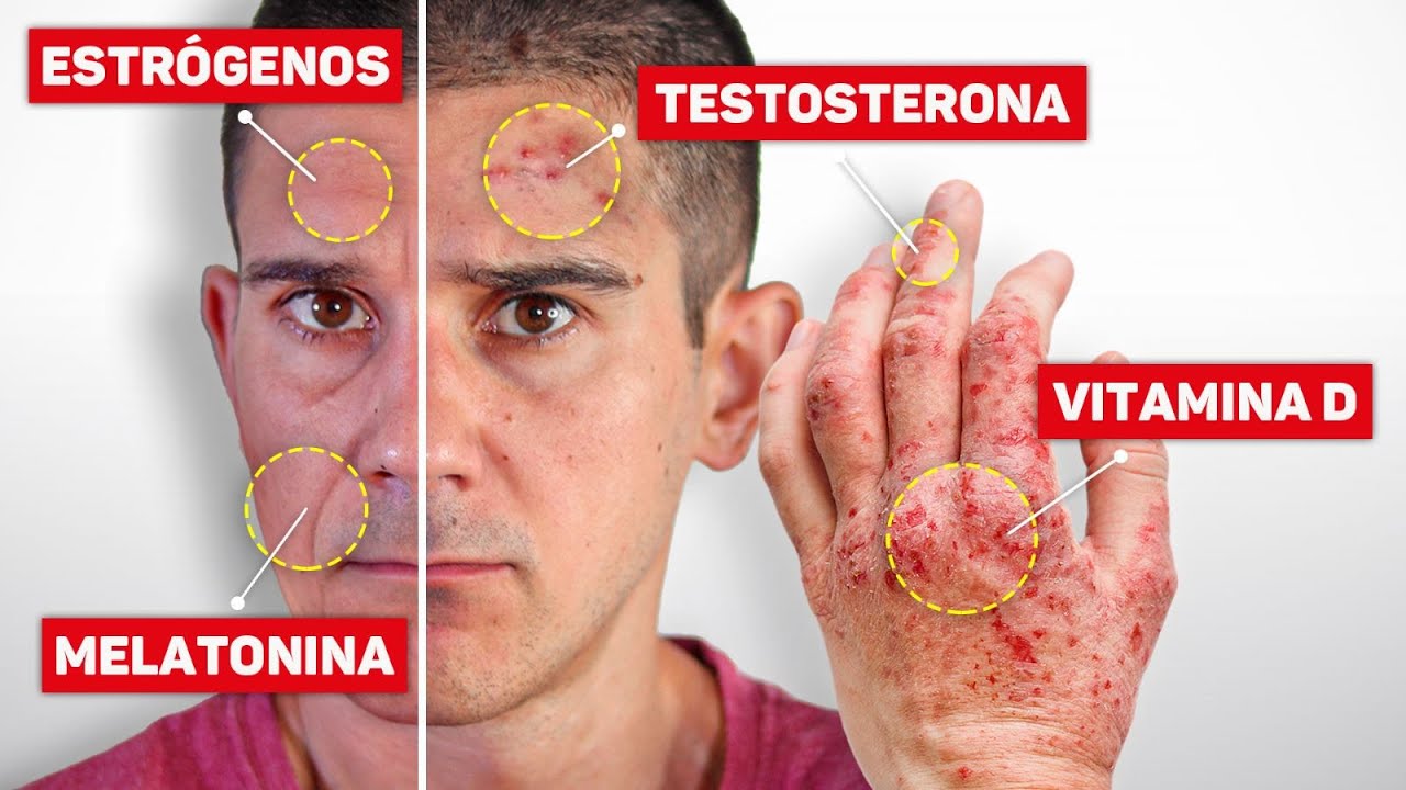 Transforma Tu Piel Entendiendo Tus Hormonas Youtube