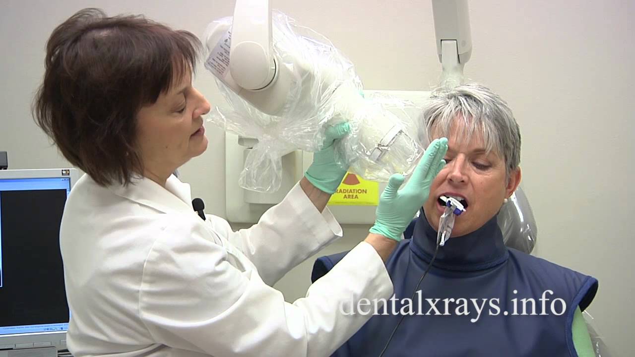 How To Take Dental X Rays With Bisecting Angle Positioning Youtube