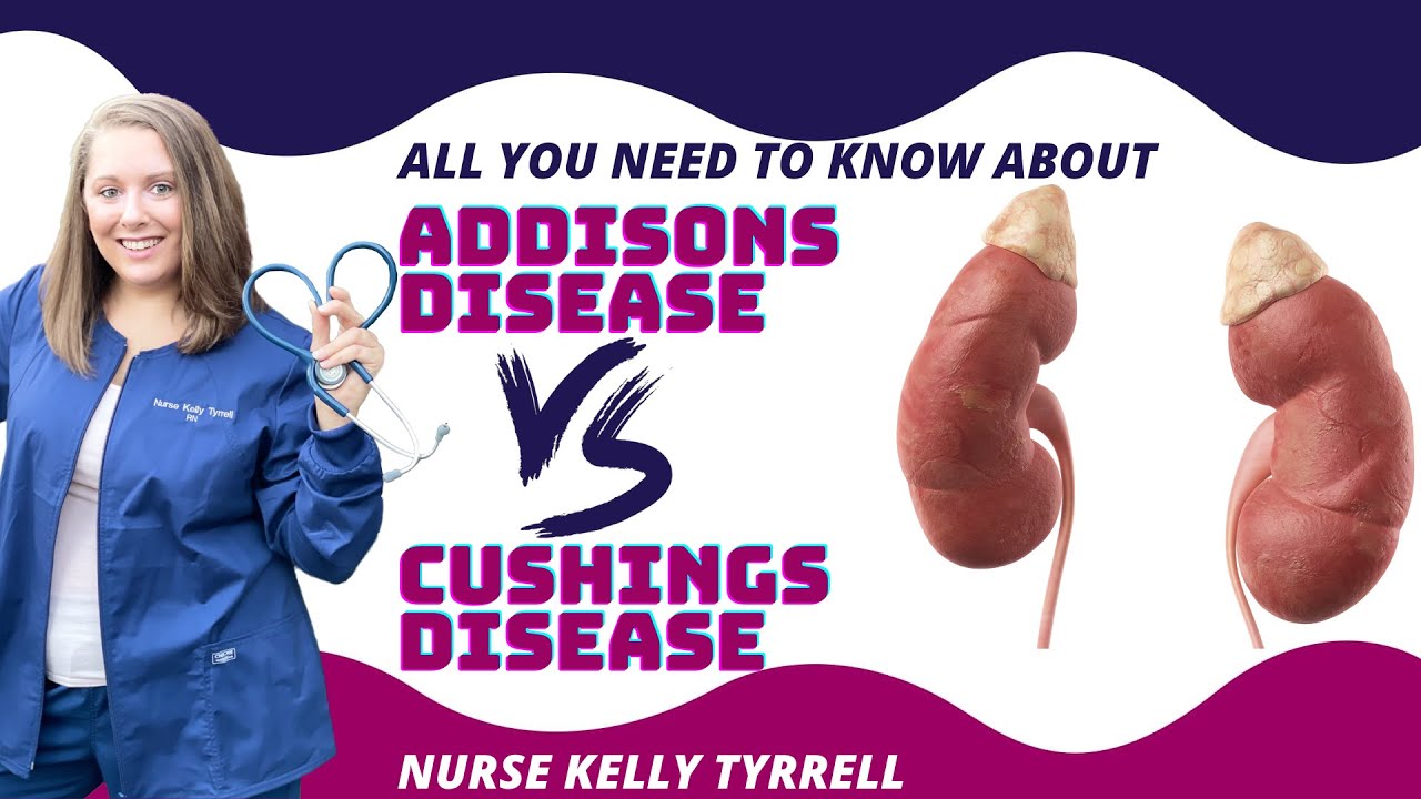 Cushing S Disease Vs Addison S Disease At Freddie Steed Blog