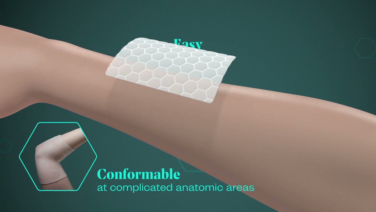 Matriderm Flex Dermal Matrix Youtube