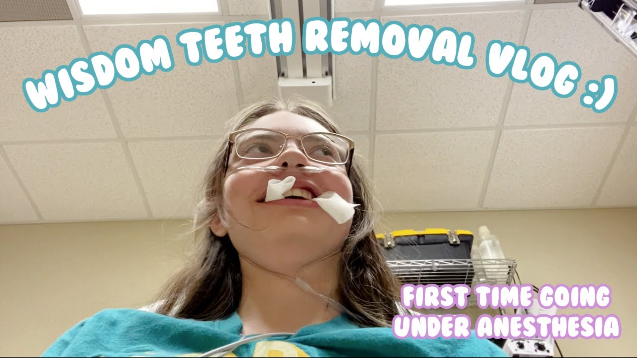 Dental Anesthesia Wisdom Teeth Removal At Armando Jackson Blog