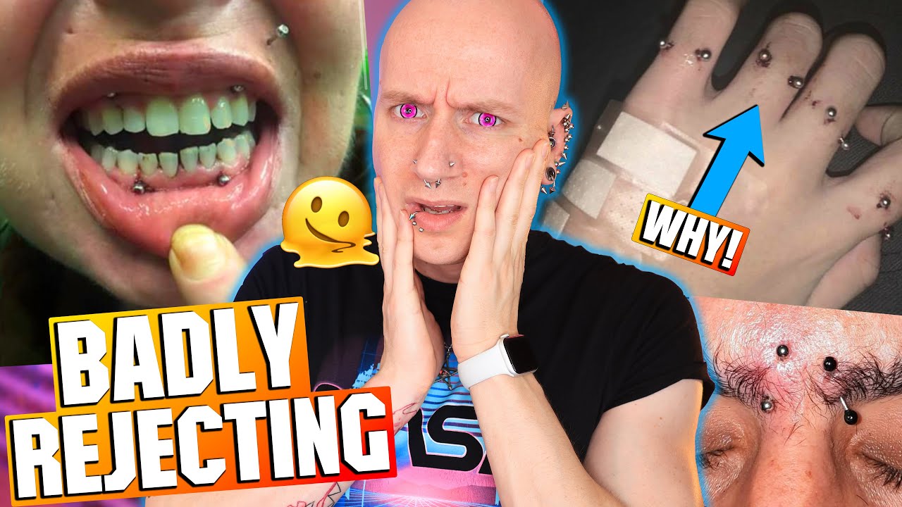 When Surface Piercings Go Very Wrong New Piercing Fails Roly Youtube