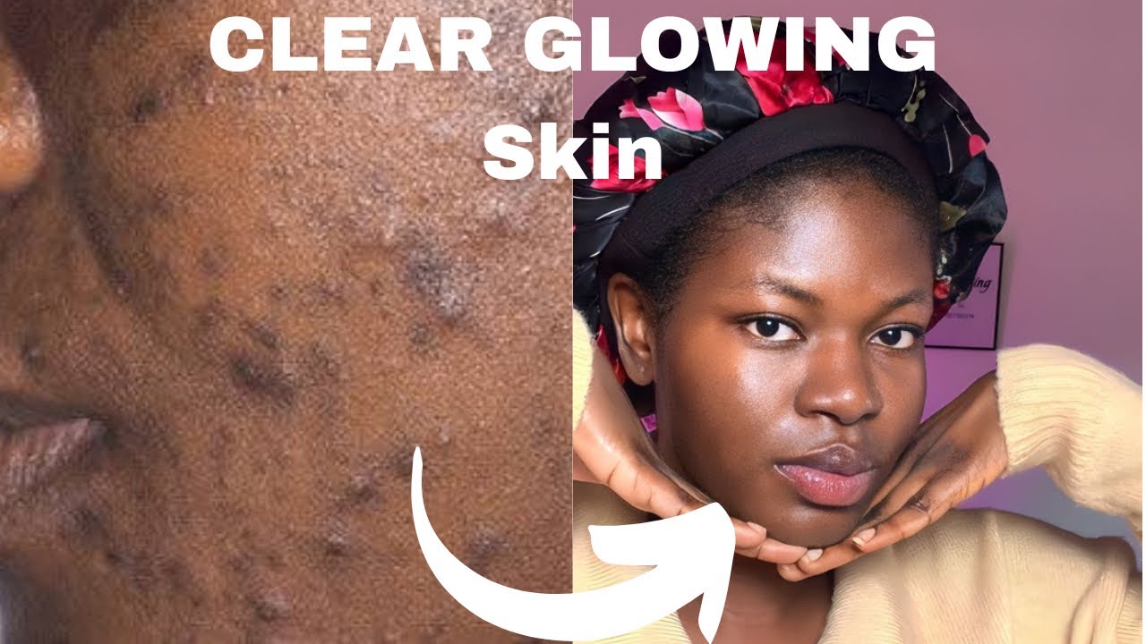 Dermatologist Approved Skincare Routine For Glowing Skin 2024 How To