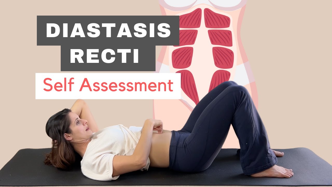 Diastasis Recti Assessment How To Check For Abdominal Separation