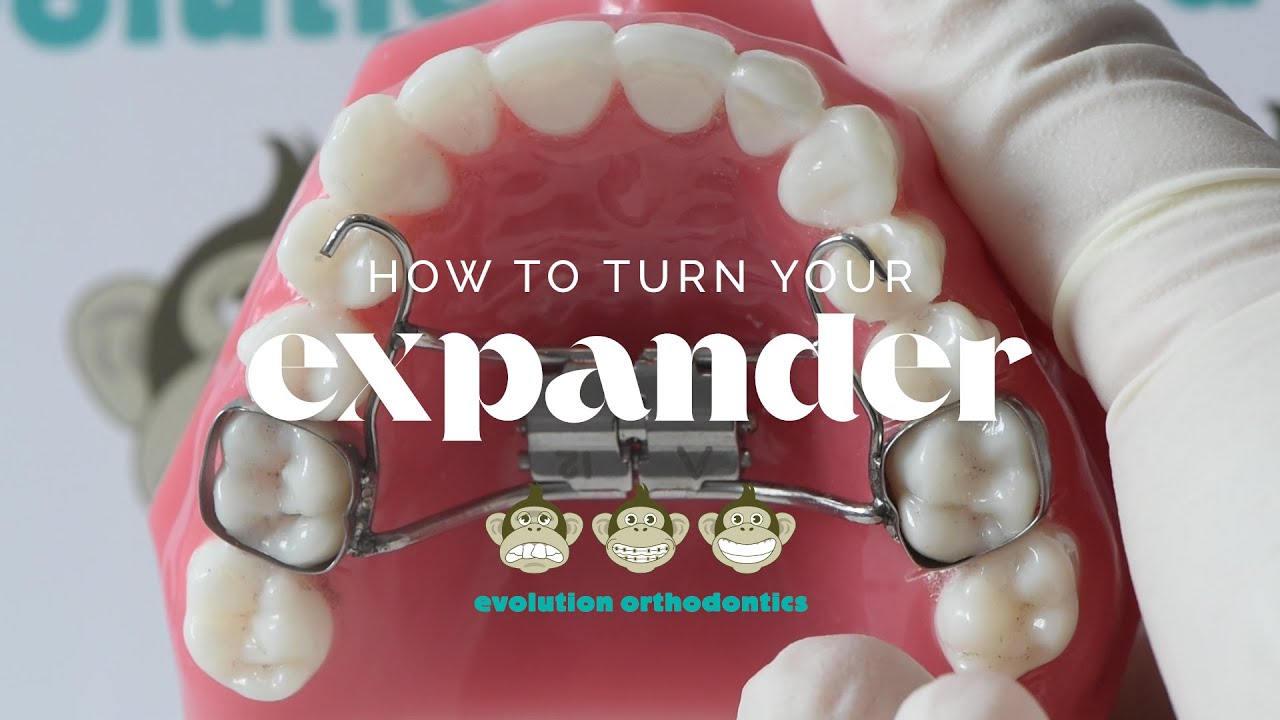 How To Turn Your Expander Youtube