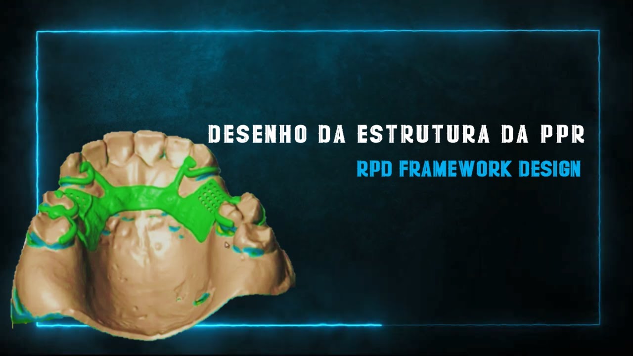 Desenho Da Estrutura Da Ppr Rpd Framework Design Youtube