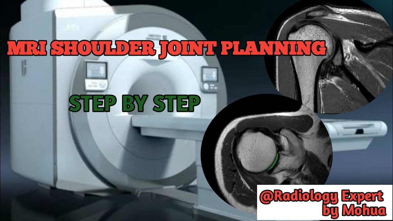 Shoulder Joint Mri Protocol Positioning And Planning How To Do