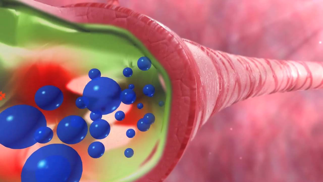 What Happens To Your Airways During Asthma 3d Animation Explained