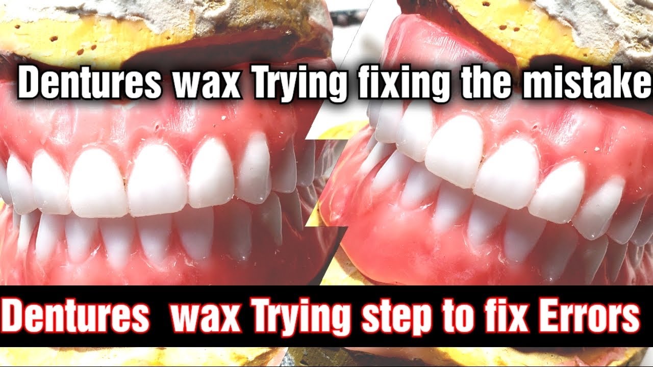Dentures Wax Trying Mistakes Errors How To Fix Them Youtube