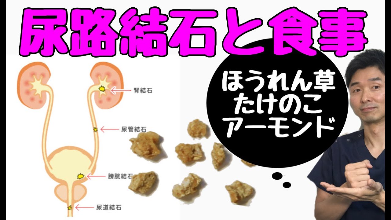 尿管結石の原因と対策 尿路結石と食事 結石とほうれん草 たけのこ アーモンド ナッツ 千葉市の腰痛専門整体院 快 Youtube