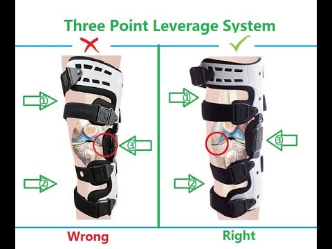 How It Works Oa Unloader Knee Brace For Osteoarthritis Bone On Bone