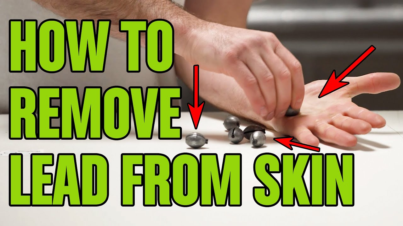 Pencil Lead Stuck In Finger At Lucinda Mccathie Blog