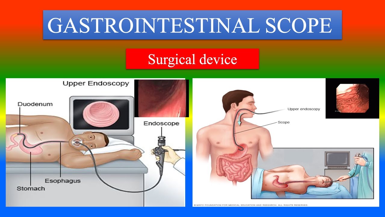Gastrointestinal Scope Definition Types Parts Uses Precautions