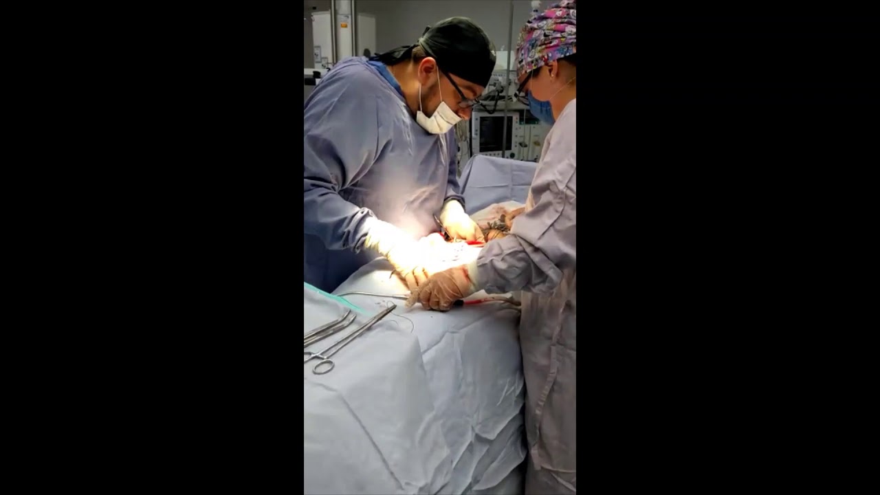 Histerectomia Total Con Salpingooforectomia Bilateral Youtube
