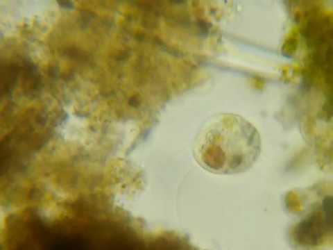 Microorganismos En Agua Estancada Pantano Bacterias Youtube
