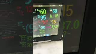 Philips Mx 550 Patient Monitor Biomedical Hospitalequipment ...