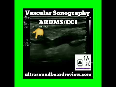 Vascular Sonography Board Review Youtube