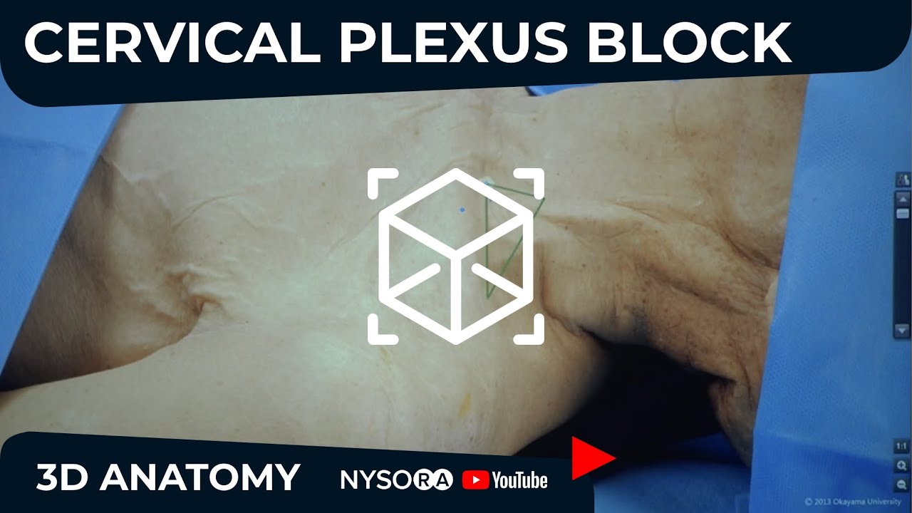 Cervical Plexus Block Nysora S 3d Anatomy Video Youtube