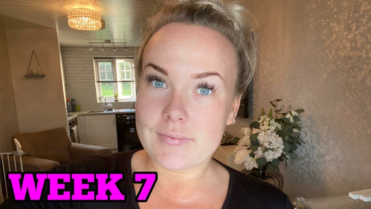 7 Weeks Post Op Youtube