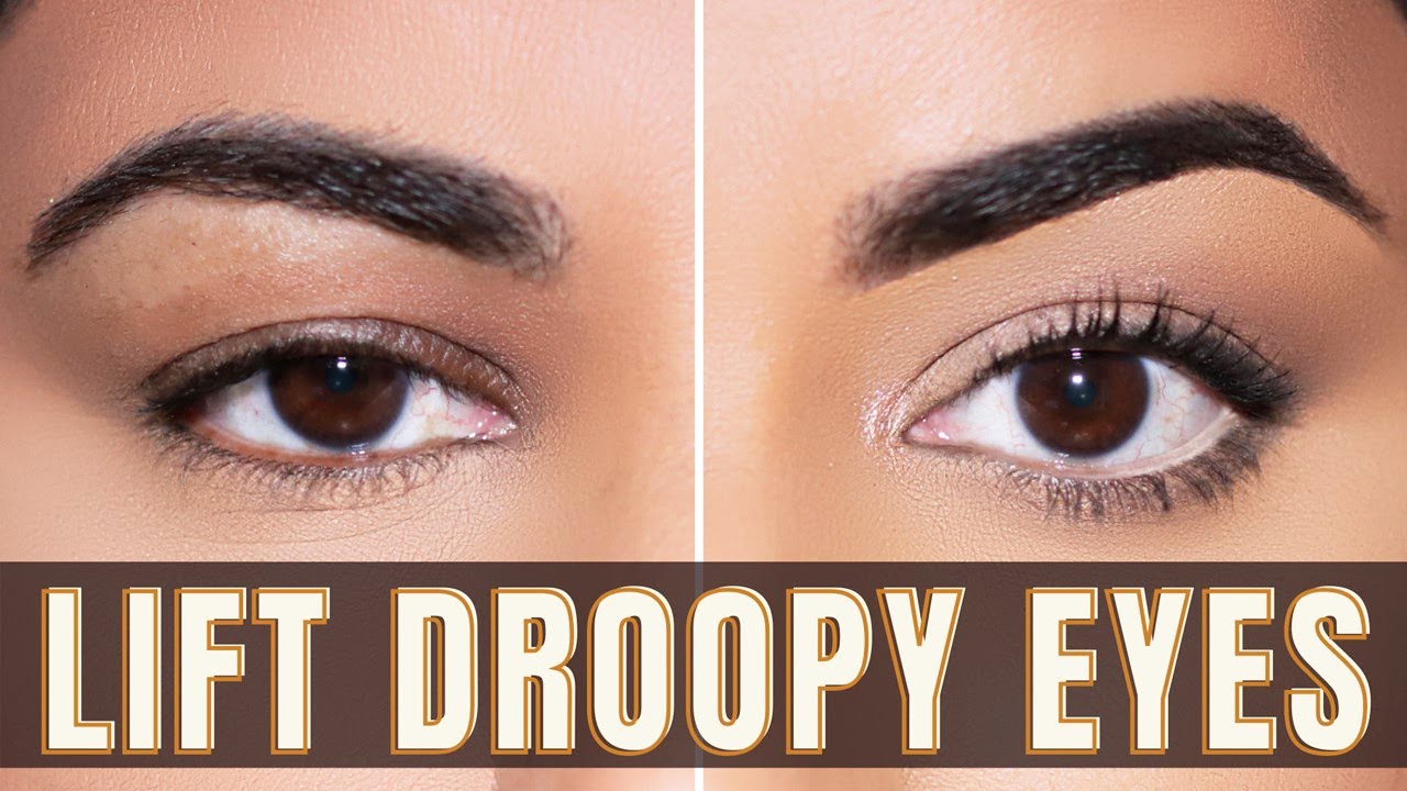 Droopy Eyelid Fix Without Surgery Infoupdate Org