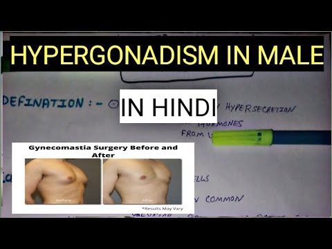 Hypergonadism In Hindi What Is Hypergonadism Youtube