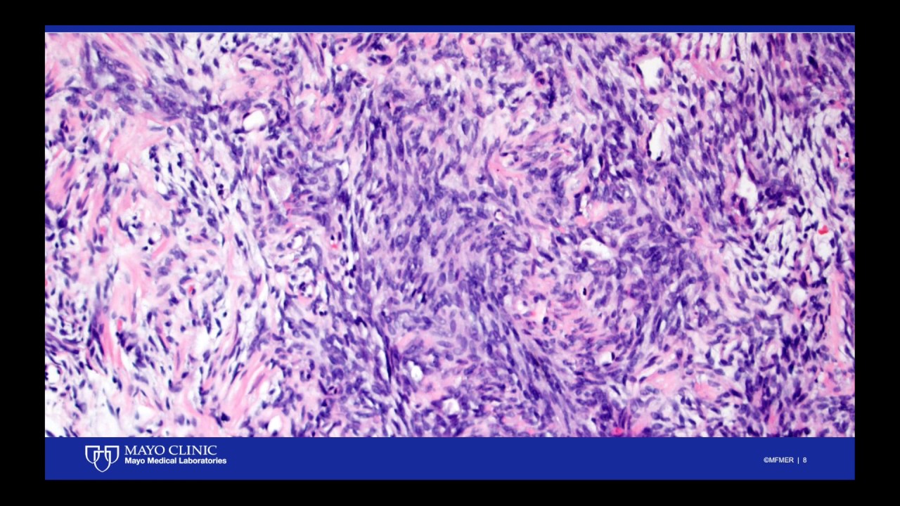 Cases With Dr Keeney Case 1 Youtube