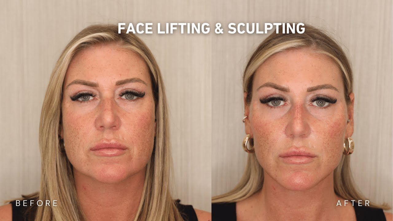 Face Lifting Sculpting Youtube