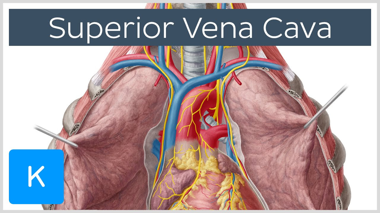 Bilateral Superior Vena Cava Is This Rare Condition Serious