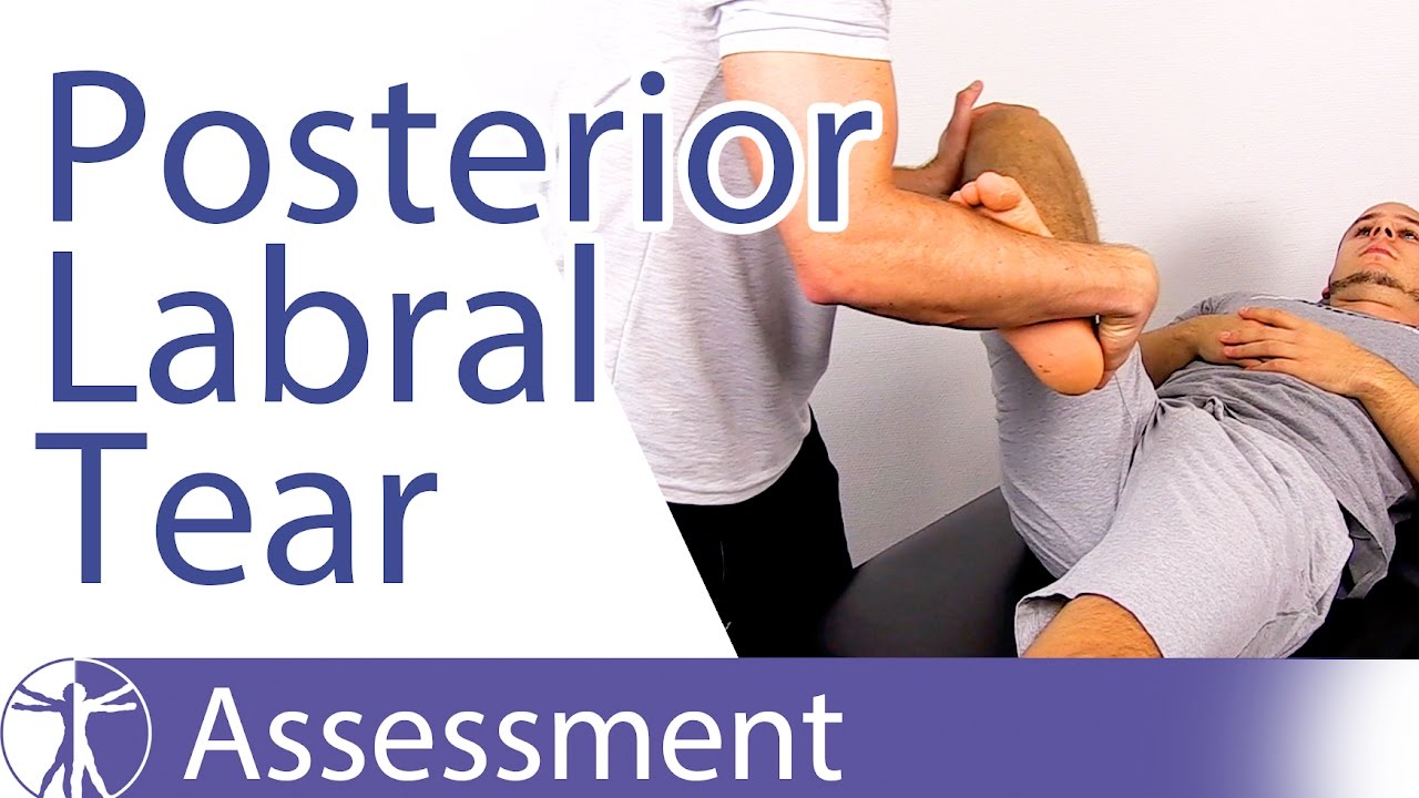 Posterior Labral Tear Testвћџlabral Tear Youtube