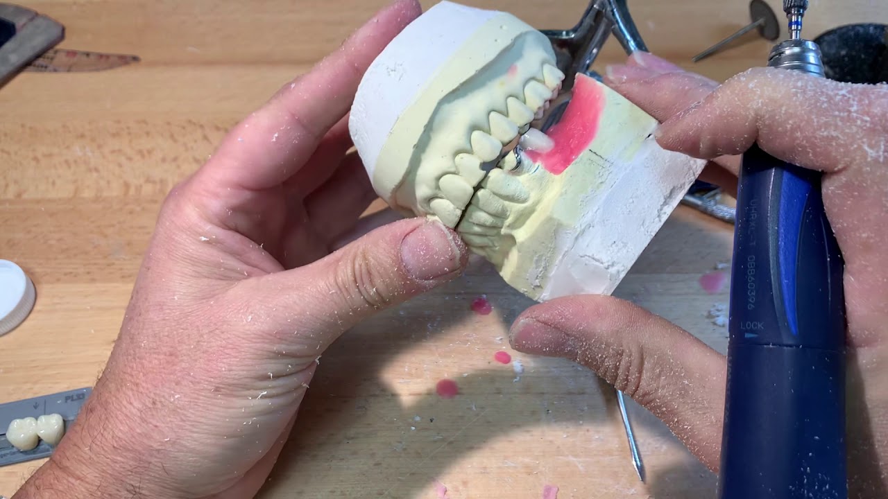 Dent 2004 Project 1 Set Up For Try In Youtube