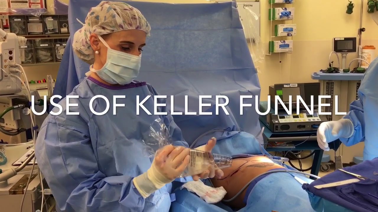 Breast Implant Surgery Video Youtube