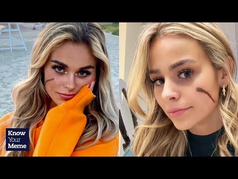 Tiktokers Accuse Scar Girl Of Faking Her Injury For Clout Amid Viral