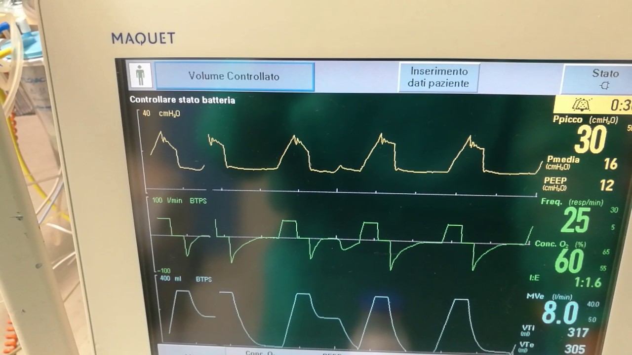 Trigger Meaning Trigger Examples Triggering
