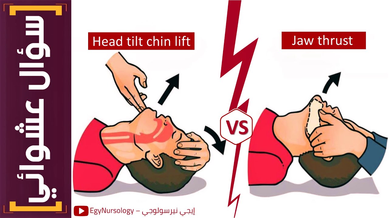 Head Tilt Chin Lift Maneuver Jaw Thrust Maneuver 53 Off