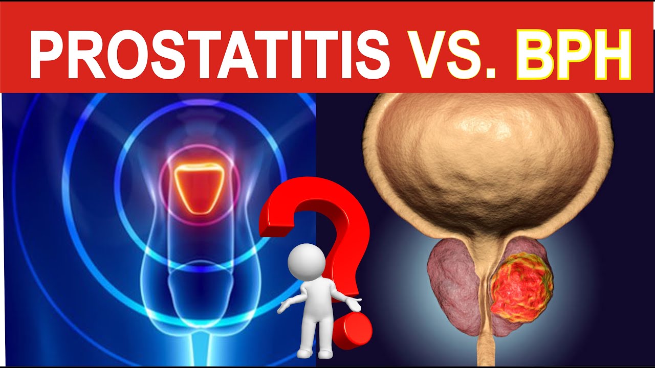 Prostatitis Vs Bph What Is The Difference Youtube