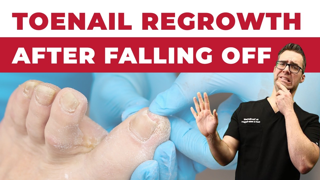 Why Are My Toenails Falling Off Toenail Regrowth After Falling Off