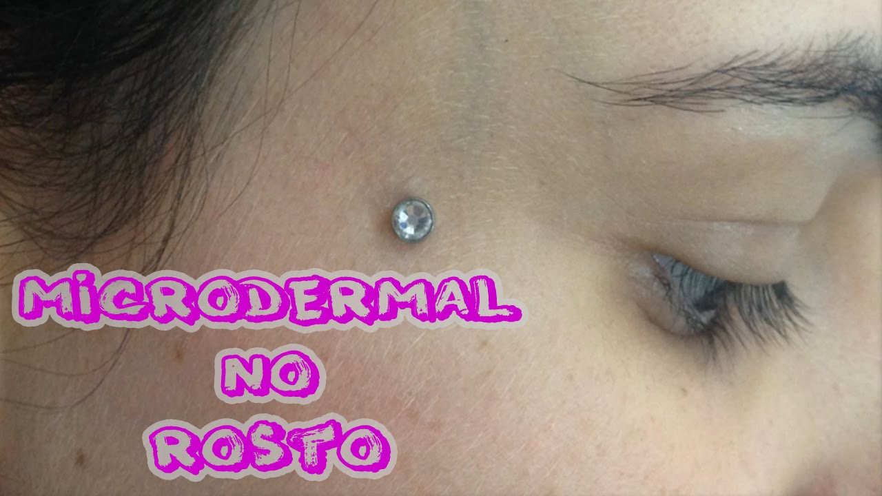 Microdermal No Rosto Microdermal The Face Youtube