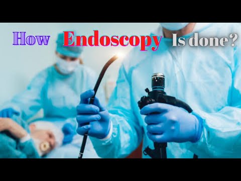 How Endoscopy Is Done Gastroscopy Youtube