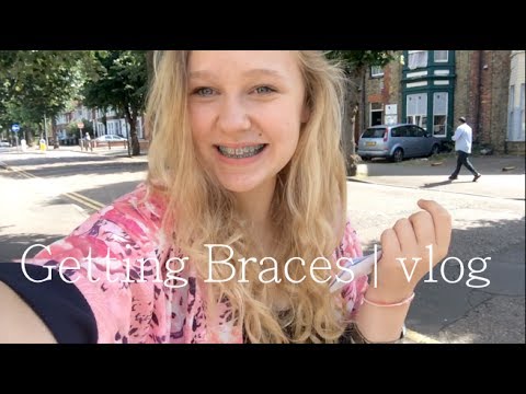 Getting Braces Vlog Youtube